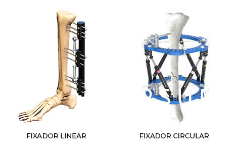INFORMAÇÕES AO PACIENTE – ORTHOPELE